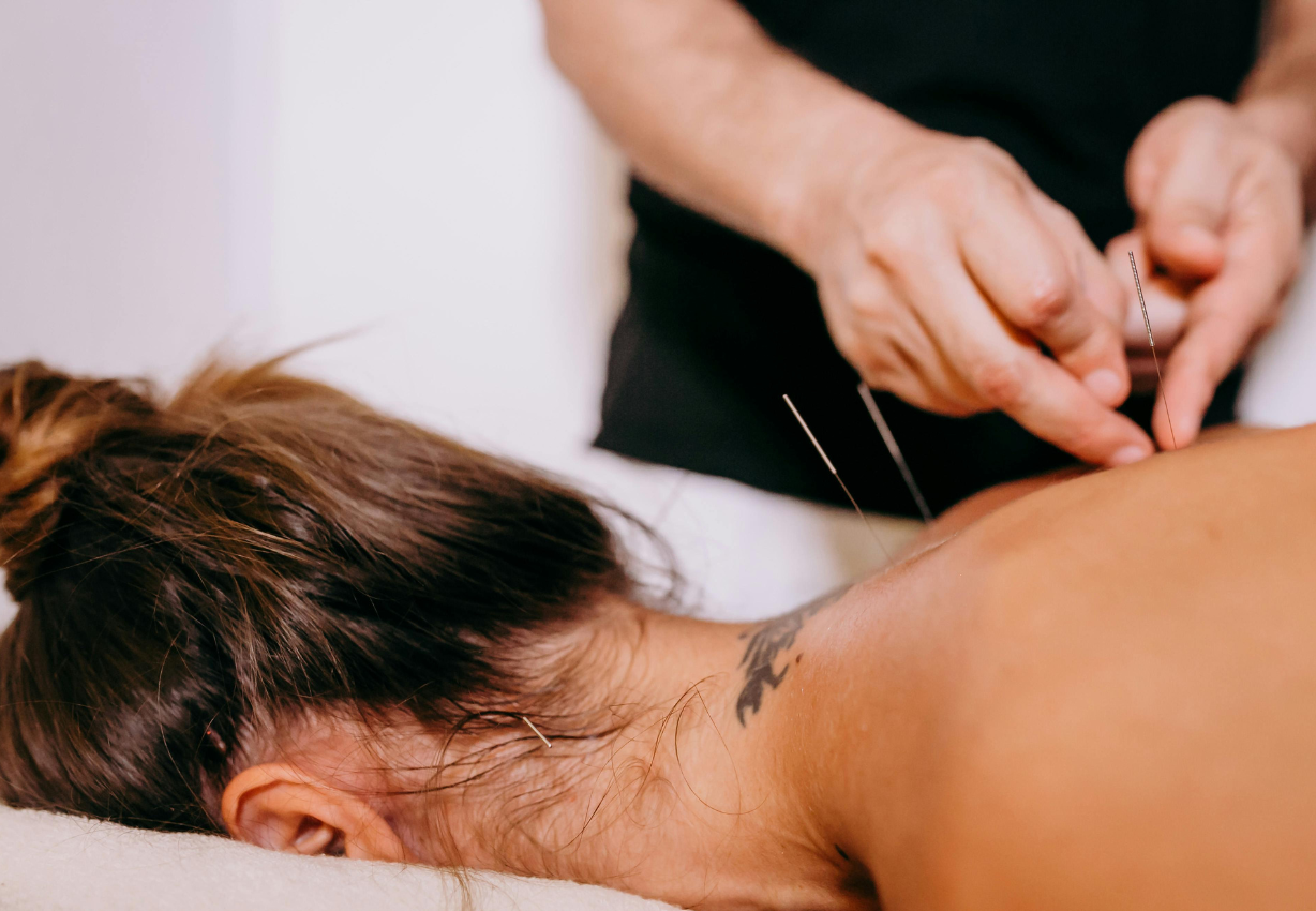 Acupuncture Treatment Plan