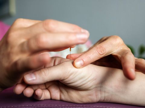 Acupuncture for Pain Relief in Victoria BC
